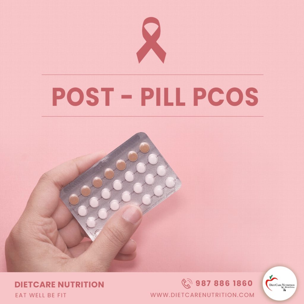 PCOS - The Scourge of Women of Reproductive Age